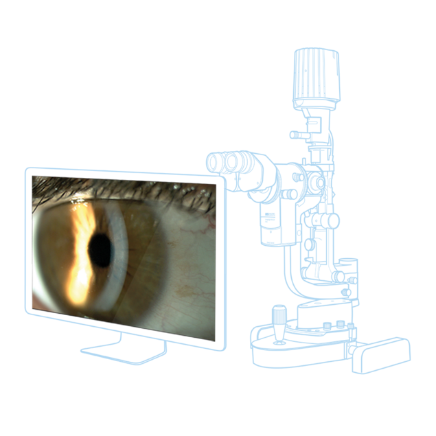 Slit lamp imaging